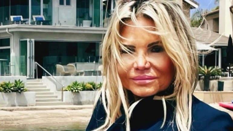 Lisa Helou’s Before And After Look: Selling the OC Star Sparks Rumors ...