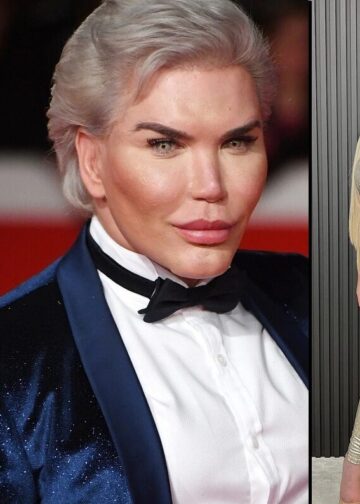 Jessica Alves Before And After: Transformation From A Human Ken Doll To ...