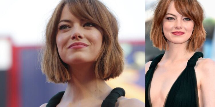 Emma Stone Before And After: What Cosmetic Surgery Did The Actress Go ...