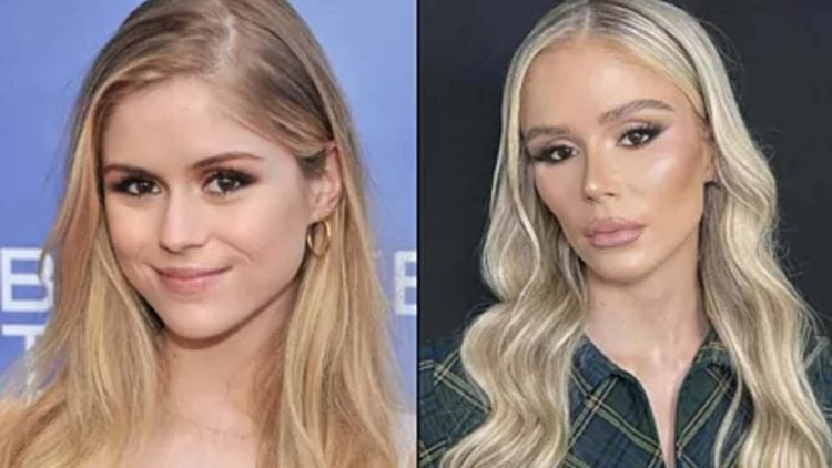 What Happened To Erin Moriarty? The Drastic Change to Her Face — OtakuKart